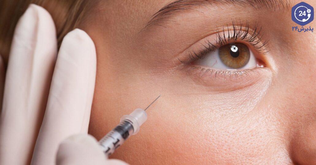 راهنمای کامل انواع تزریق فیلر به صورت | پذیرش۲۴